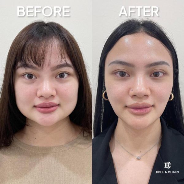 Top 20 Best Aesthetic Clinics in KL & Selangor 2023 | Latest 2023